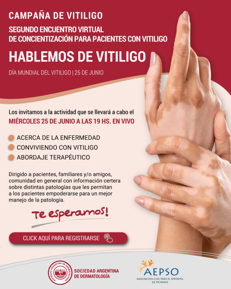 Campaña de Vitiligo – Segundo encuentro virtual de concientización de ...